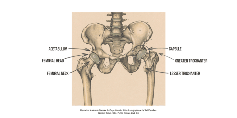 Isolated Hip Fracture: What trauma registrars need to know
